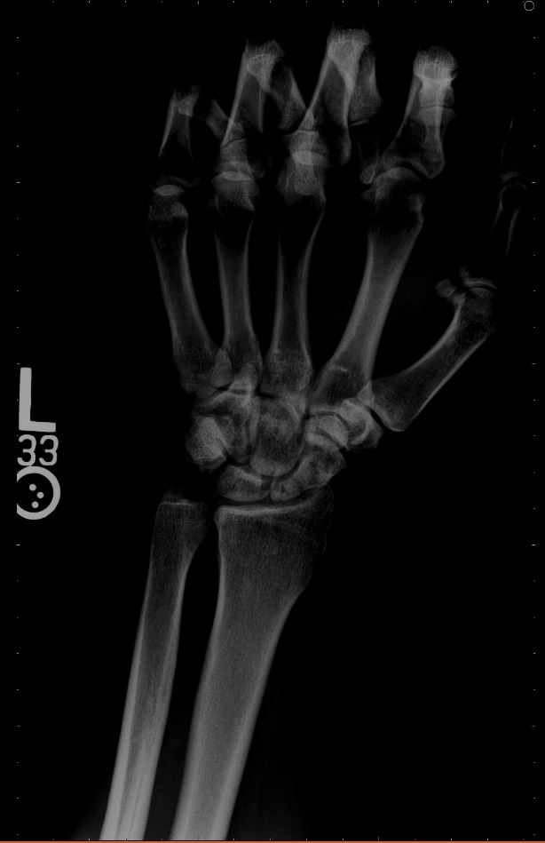 Guidelines For Image Evaluation Digital Radiographic Exposure Principles And Practice