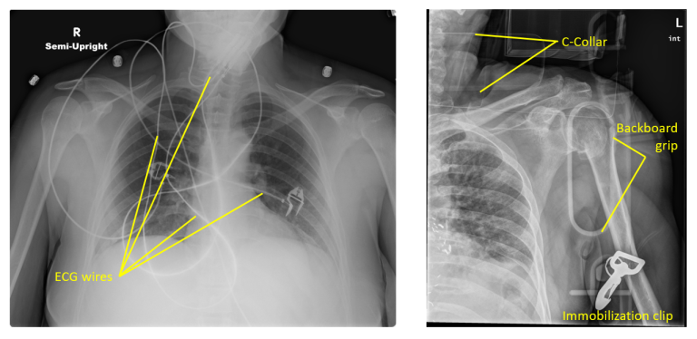 Guidelines For Image Evaluation Digital Radiographic Exposure Principles And Practice