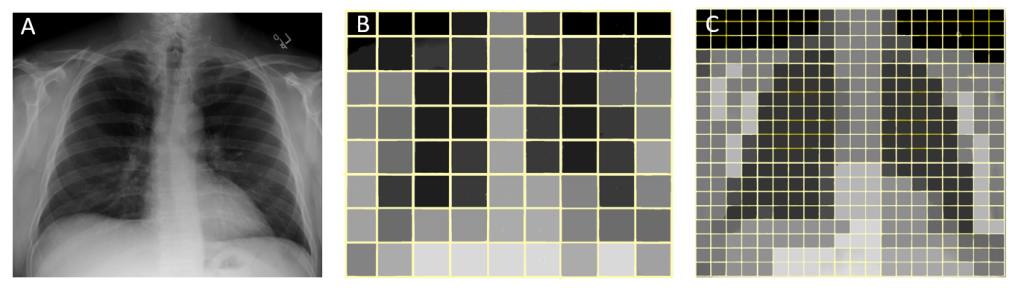Image Capture and Display – Digital Radiographic Exposure: Principles ...