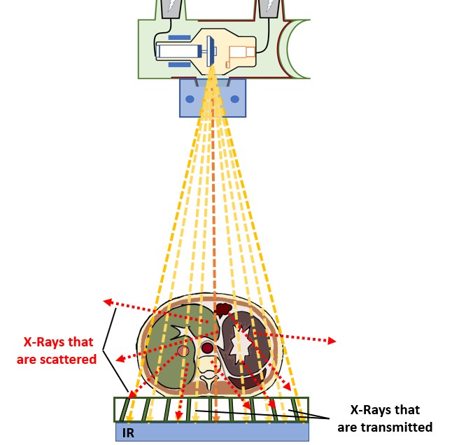 Grids And Beam Restriction Digital Radiographic Exposure Principles And Practice