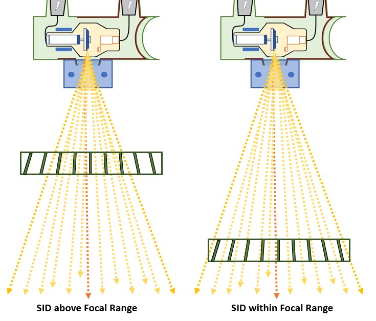 Grids And Beam Restriction Digital Radiographic Exposure Principles And Practice