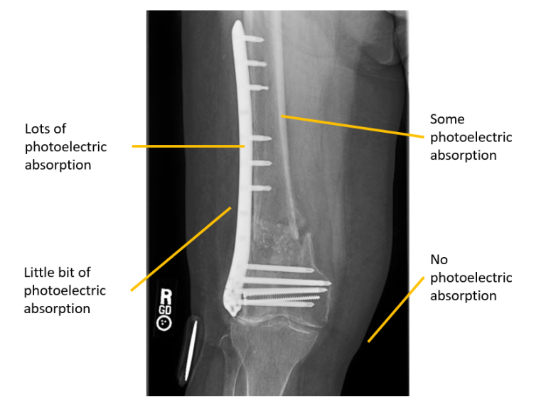 Guidelines For Image Evaluation Digital Radiographic Exposure Principles And Practice