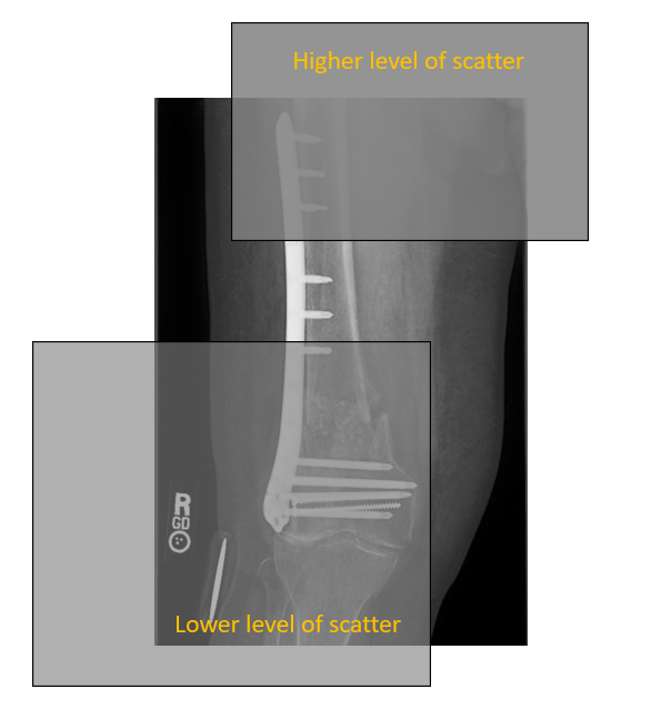 Guidelines For Image Evaluation Digital Radiographic Exposure Principles And Practice