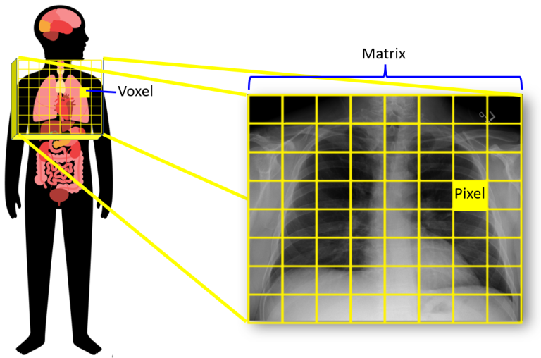 Image Capture and Display – Digital Radiographic Exposure: Principles & Practice